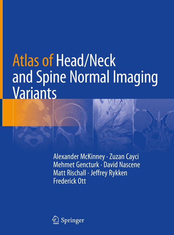 Atlas of Head/Neck and Spine Normal Imaging Variants | 9783319954400 ...