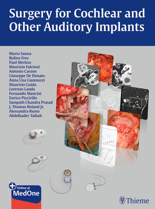 Surgery for Cochlear and Other Auditory Implants | 9783132431904 ...